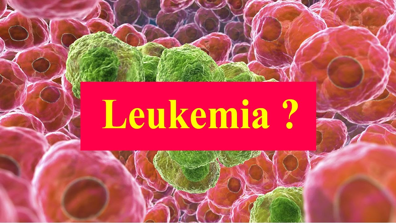 5 Yaşında Lösemi
